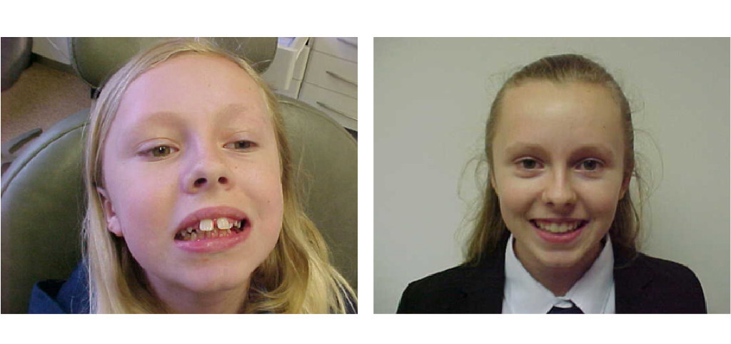 Against the Odds award winner announced - Dentistry.co.uk