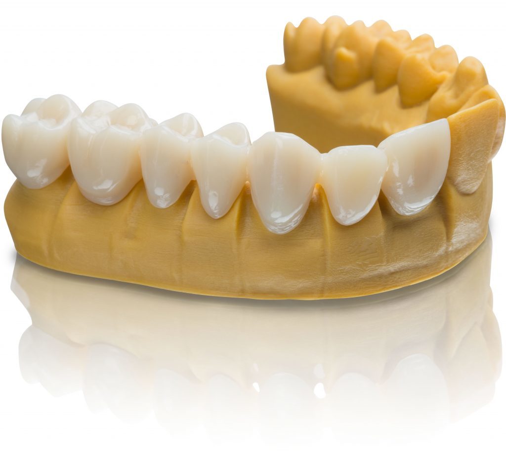 Bego expands 3D print options - Dentistry.co.uk
