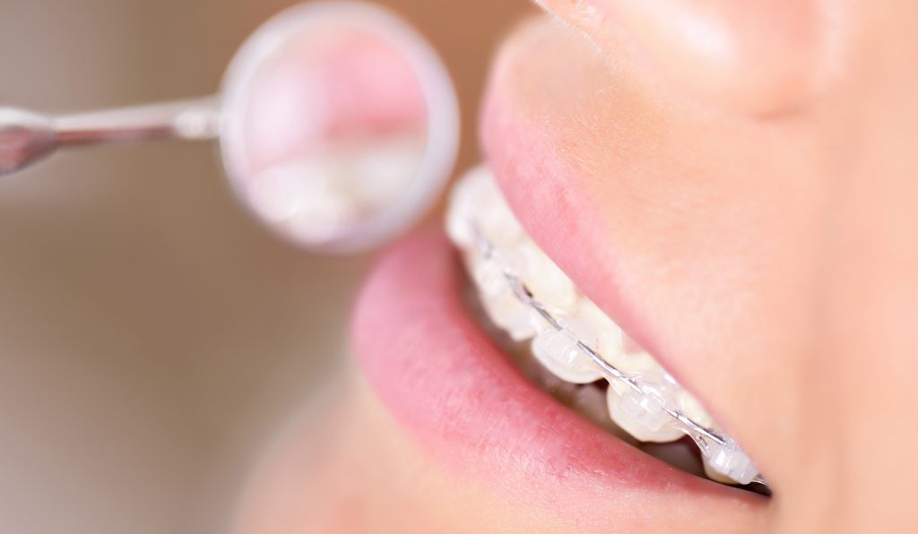 Why do we smile? Exploring the psychology behind smiling - Dentistry.co.uk