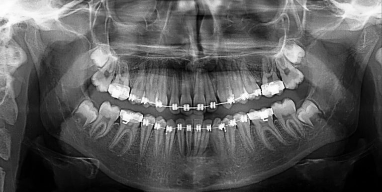 New regulations on X-ray use - Dentistry.co.uk
