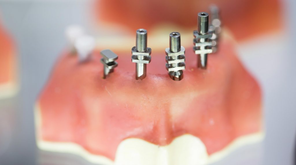 Implant training pathways - Dentistry.co.uk