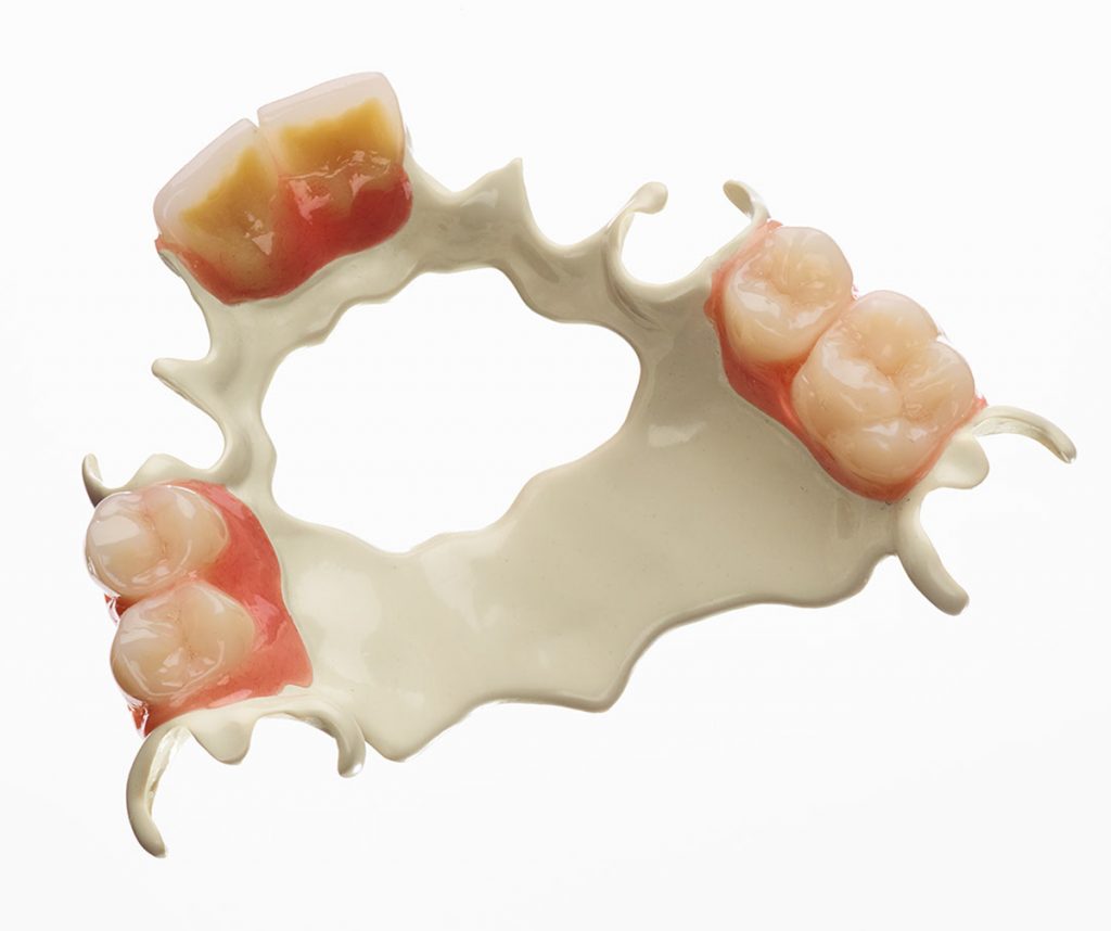 Want to offer your patients a premium alternative to metal removable ...