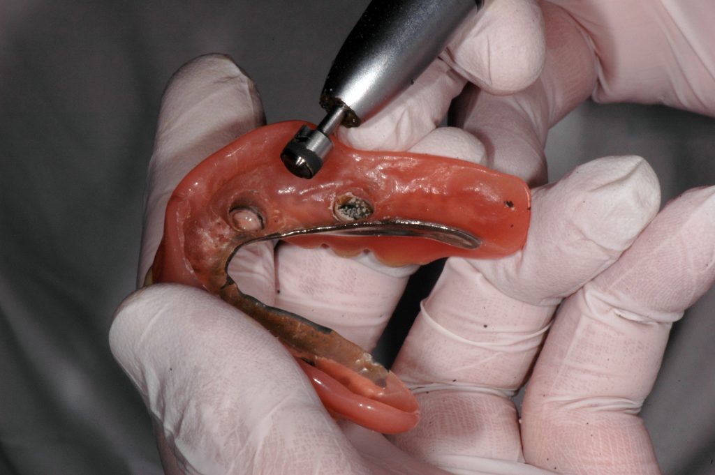 Instructions for use: CM Loc Flex implants - Dentistry.co.uk