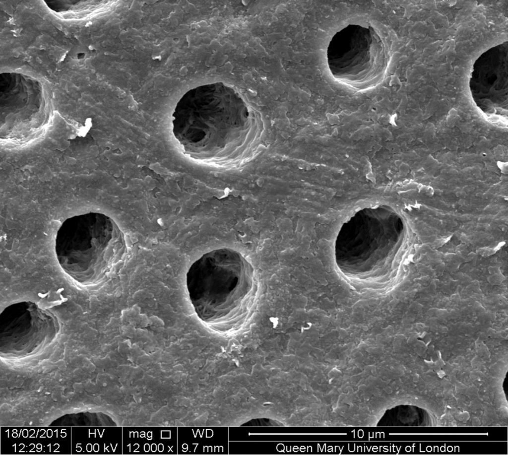 Biomin F: prevention of sensitivity following whitening treatment ...
