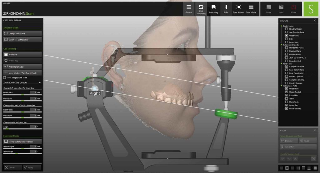 Zirkonzahn's workflow combines with the Planesystem – Dentistry Online
