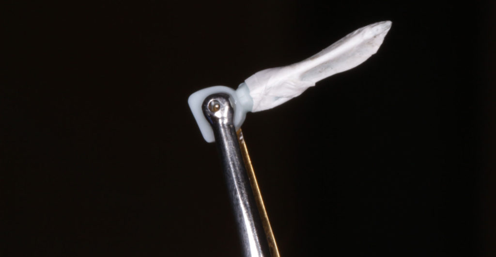 An easy fix with 3M Oral Care – Dentistry Online