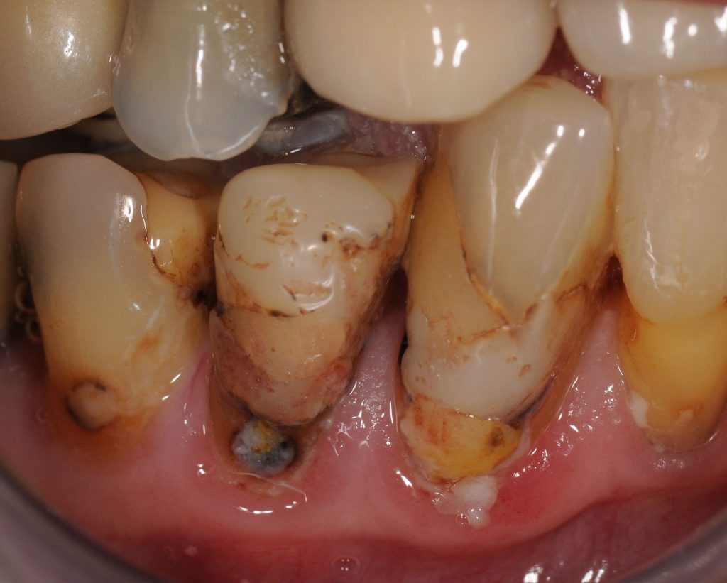 Dr Heff's – the science behind the mint - Dentistry Online