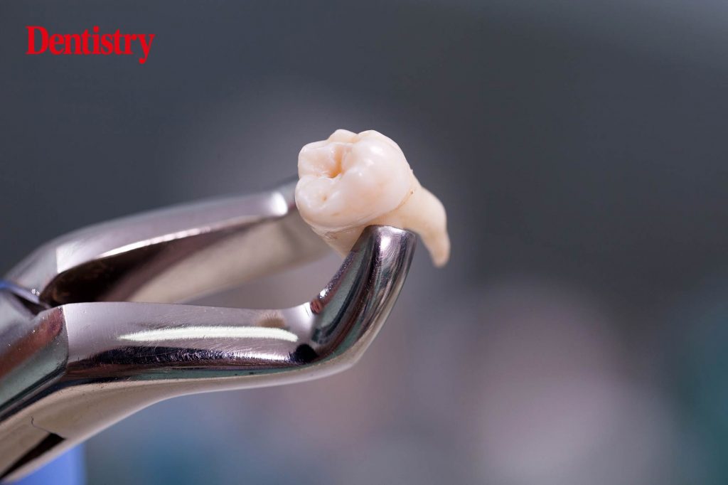 Wrong tooth extraction taken off NHS Never Event list - Dentistry Online