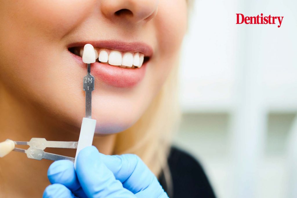 Tips for shade matching indirect restorations - Dentistry