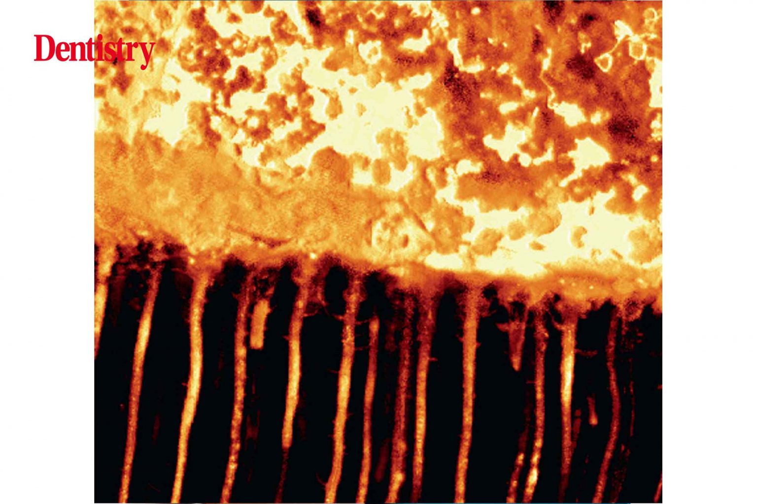 Biodentine – not just for special occasions - Dentistry