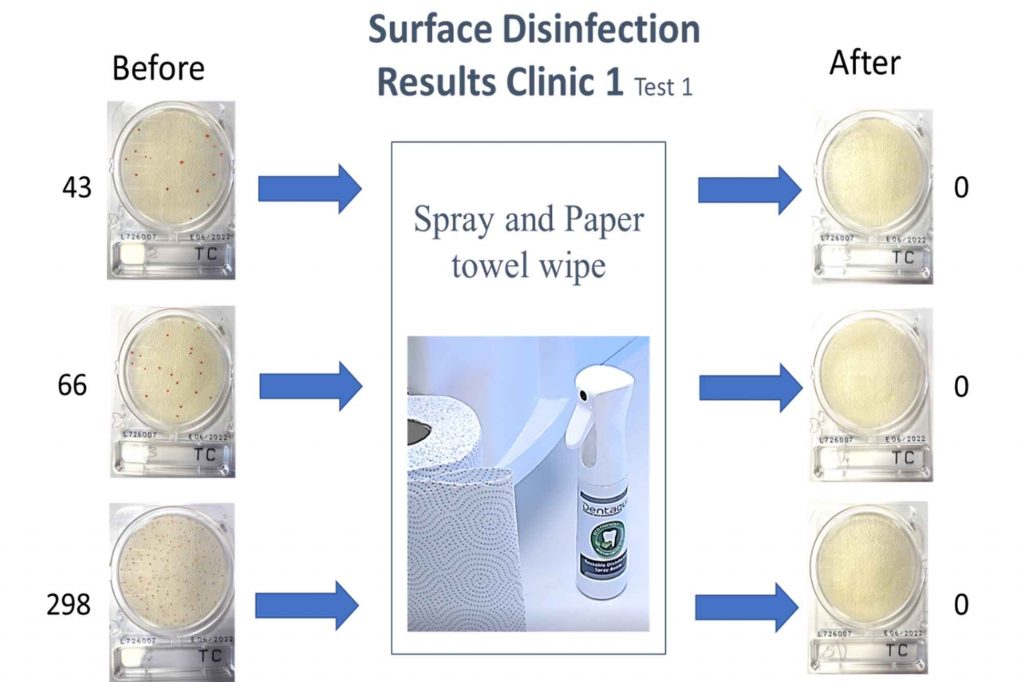 Live test of Dentaqua hypochlorous acid disinfection system - Dentistry
