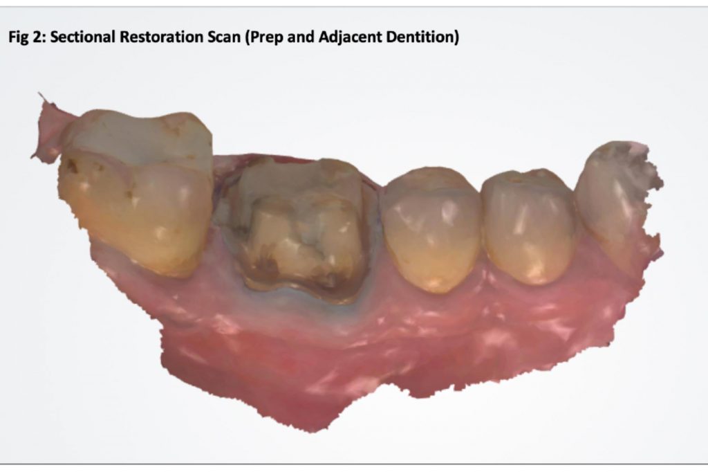 Get more from your intraoral scanner - Dentistry