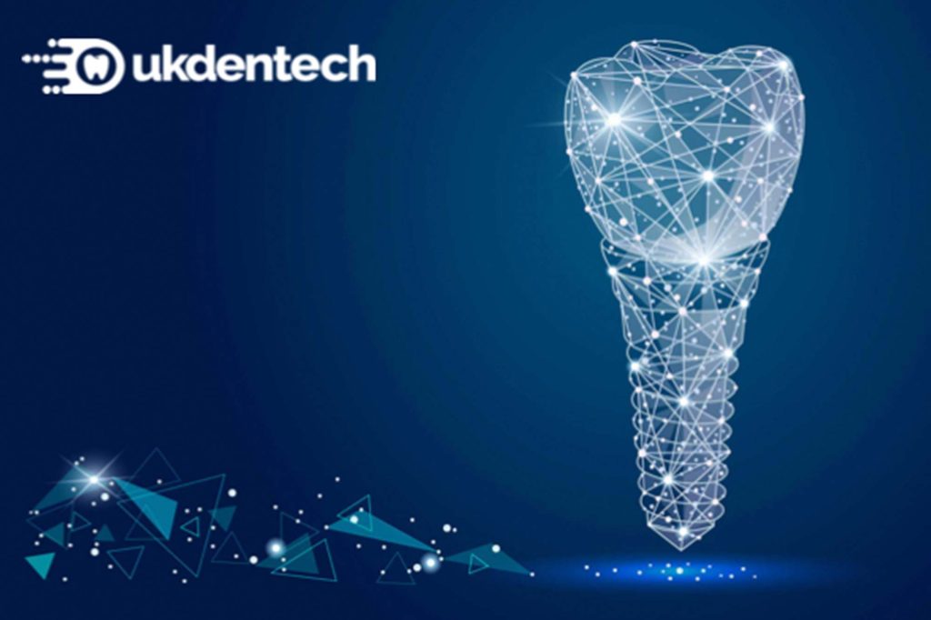 De-mystifying digital dental implants - Dentistry