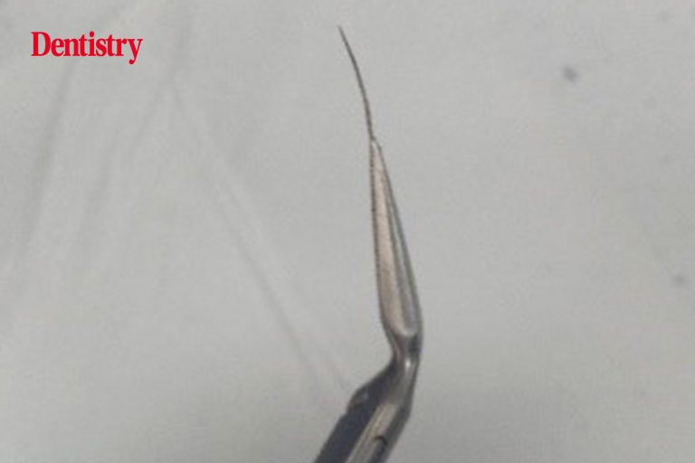 Exploring Endodontics – a silver point of order - Dentistry