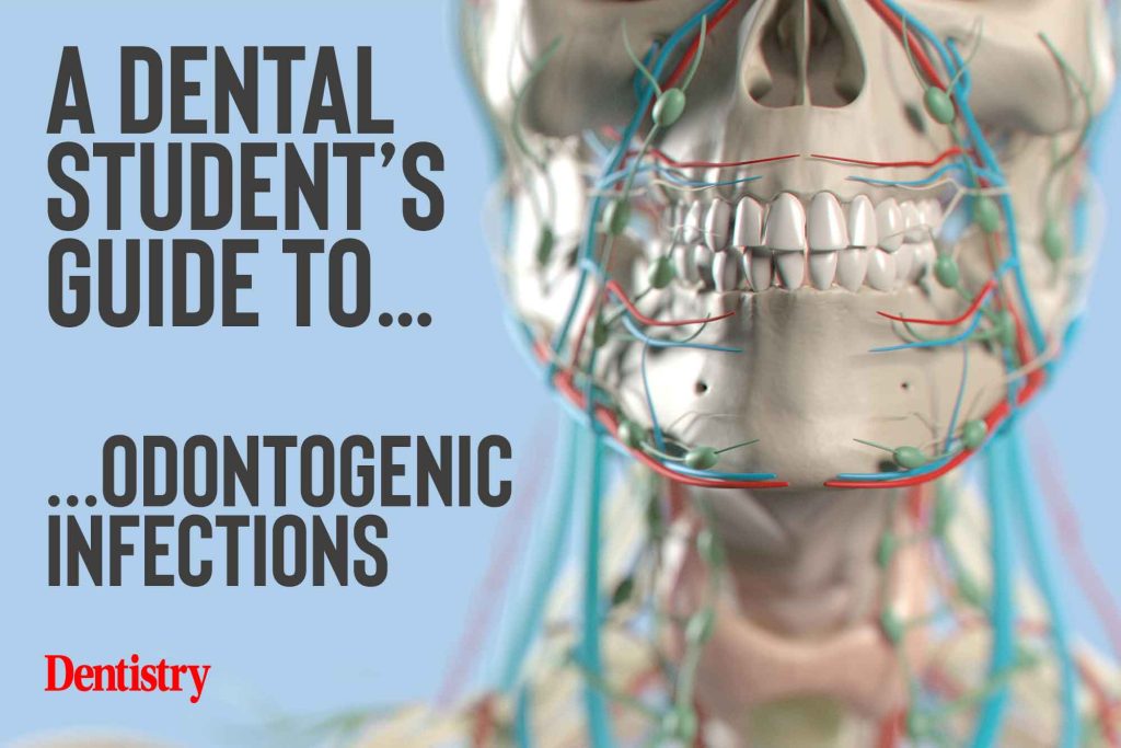 A dental student's guide to...odontogenic infections - Dentistry