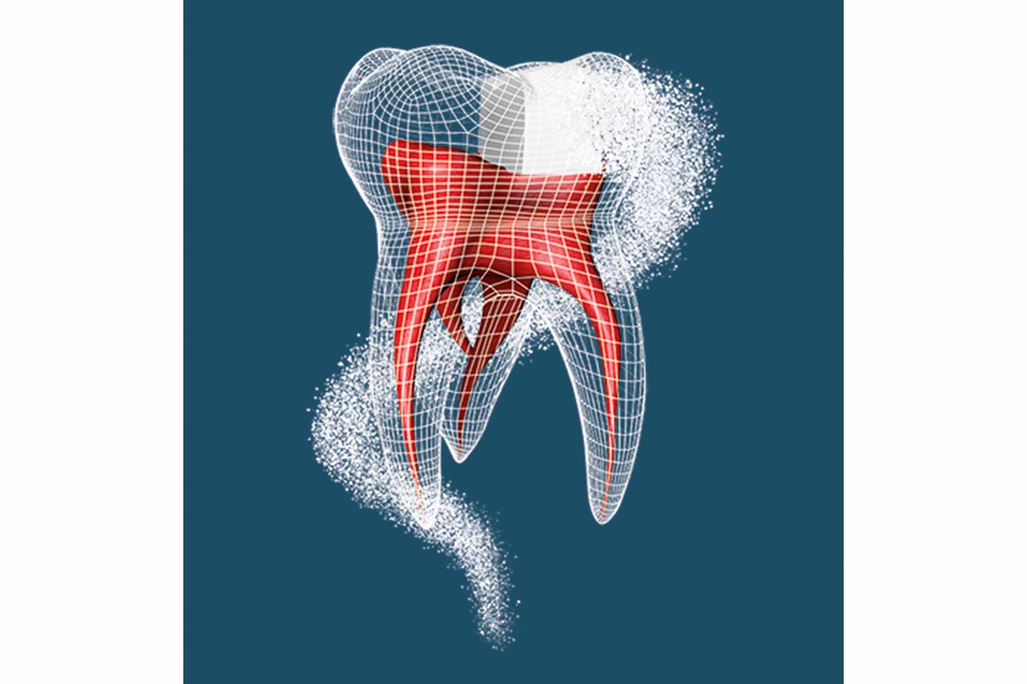 Oh-oh! It’s a big one! - Dentistry