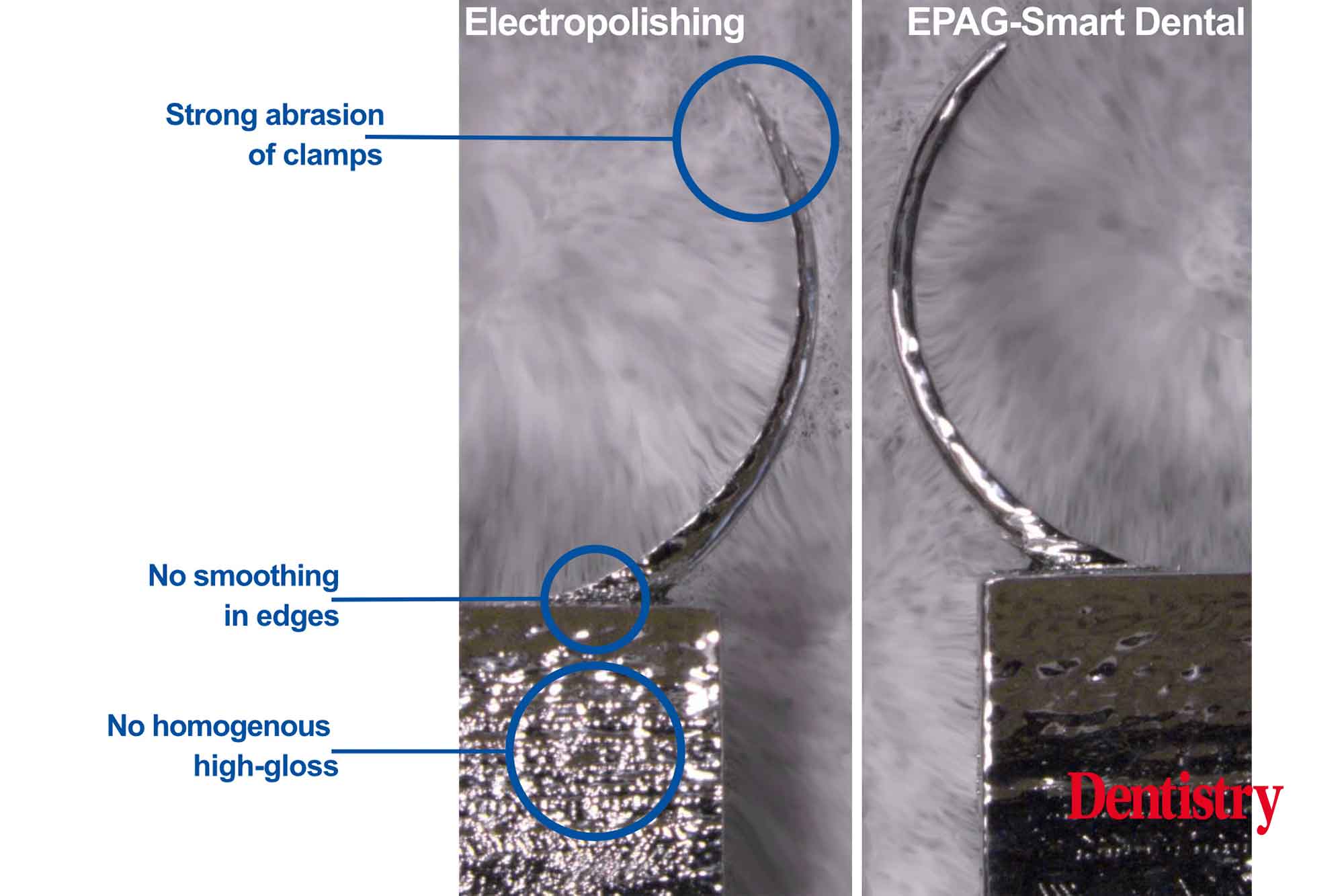 EPAG-Smart T – surface finishing for dental frameworks - Dentistry