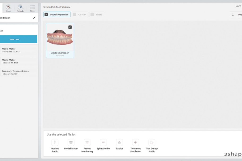 3shape Model Maker: create dental models in minutes! - Dentistry
