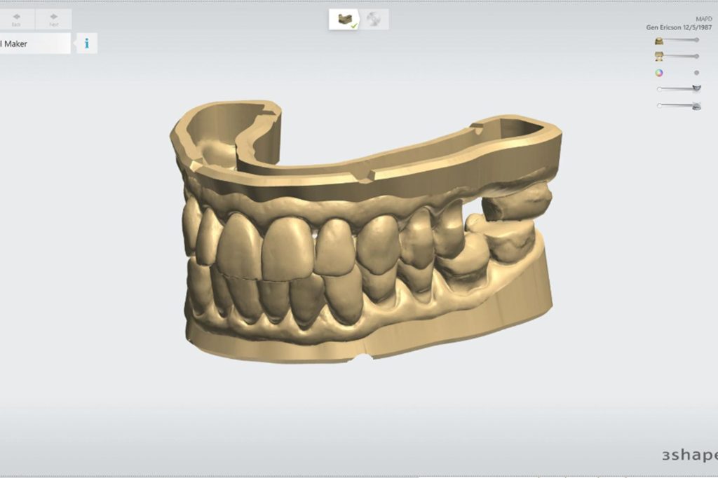 3shape Model Maker: create dental models in minutes! - Dentistry