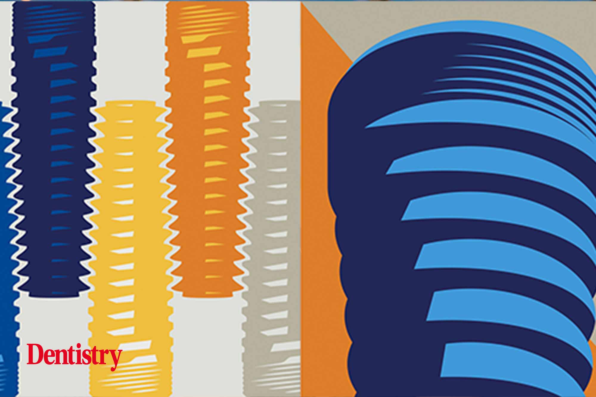Tips on using DS Primetaper from Dentsply Sirona - Dentistry
