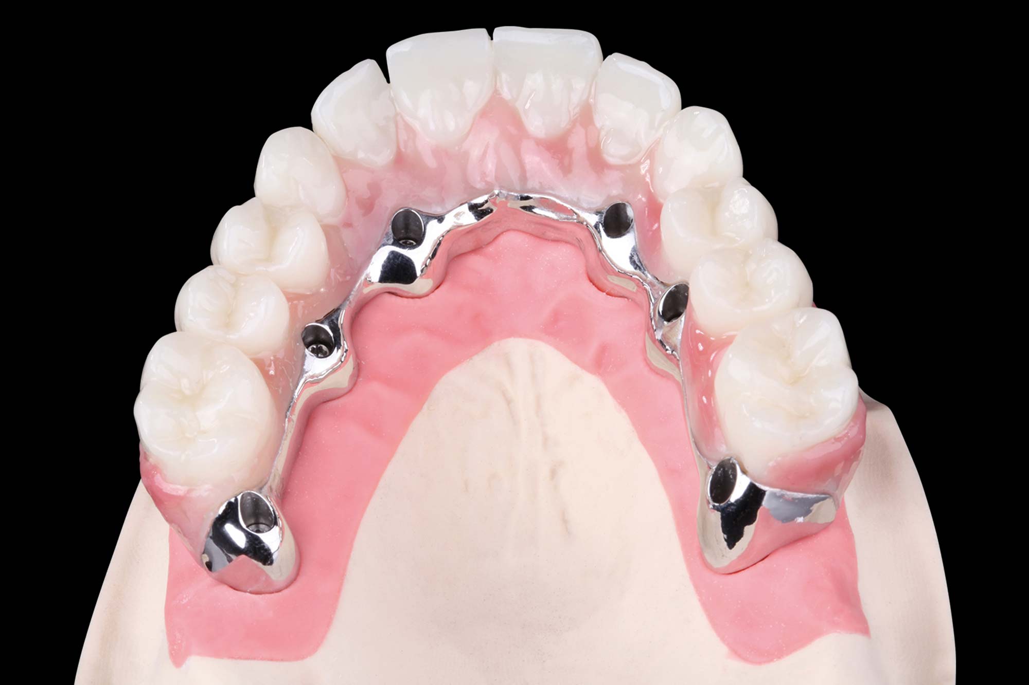 Full arches on implants – Zirkonzahn’s lecture tour - Dentistry