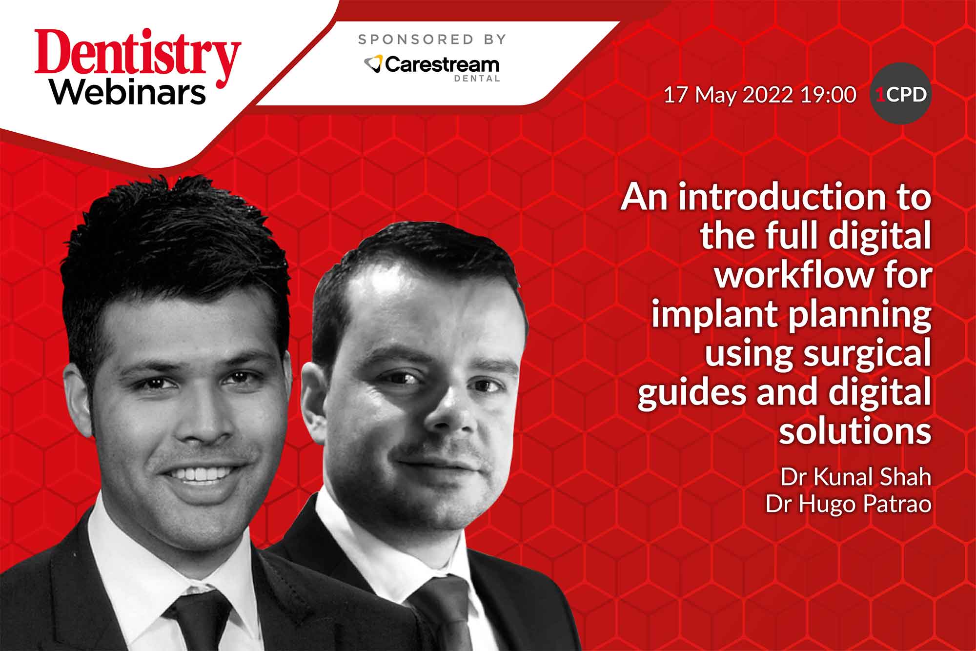 An introduction to the full digital workflow for implant planning ...