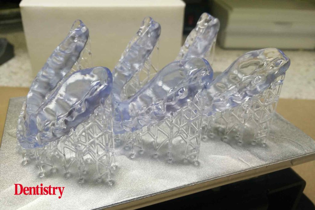 Are printed occlusal splints worth your time? – part one - Dentistry