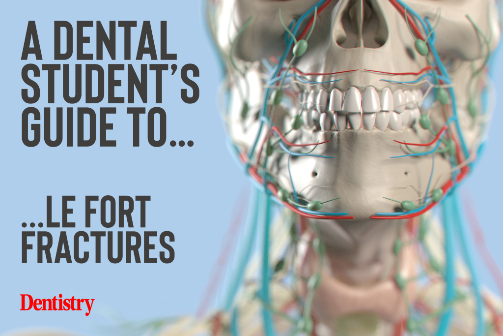 A Dental Student's Guide to...Le Fort fractures - Dentistry