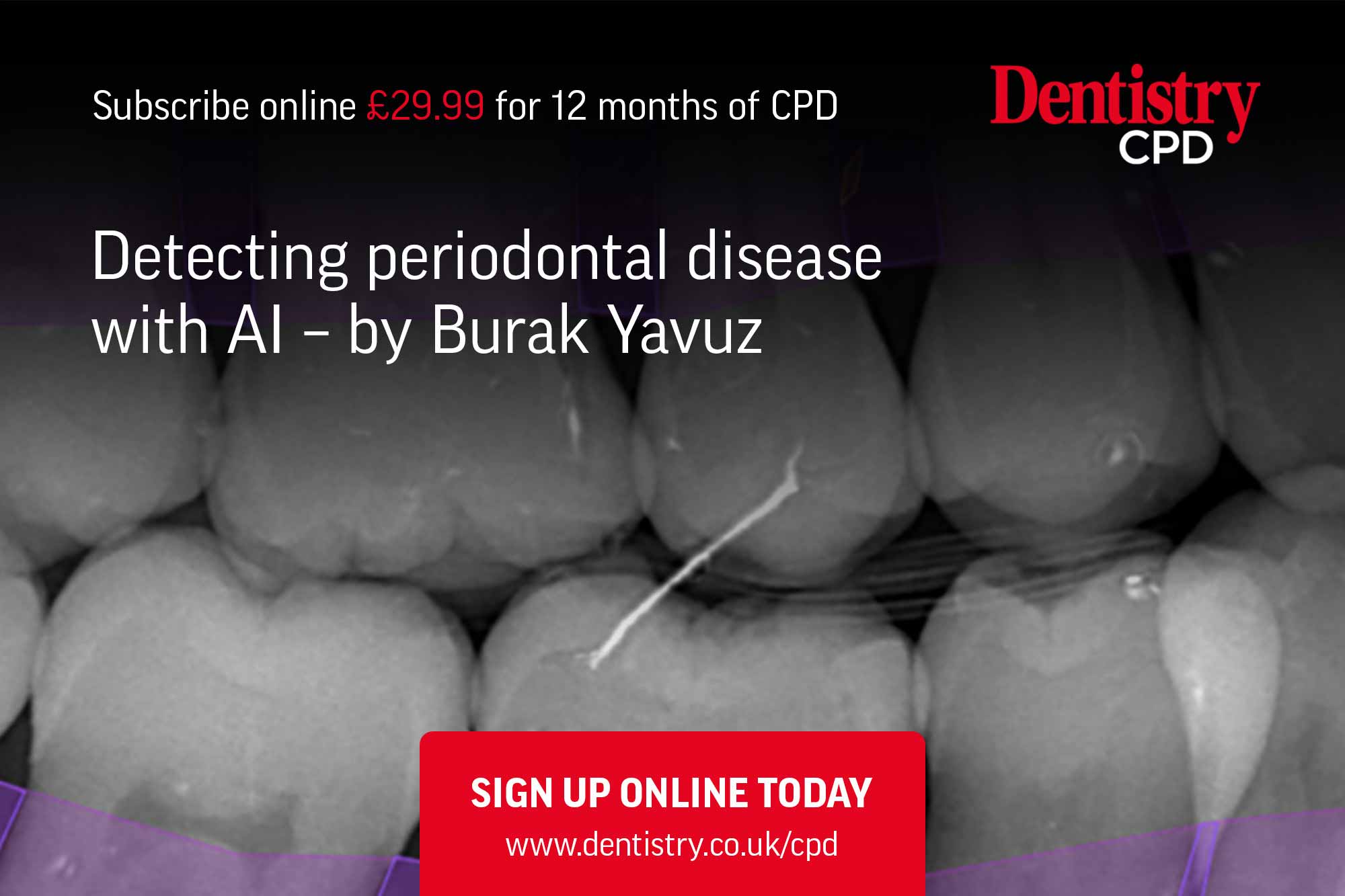 Detecting periodontal disease with AI - Dentistry