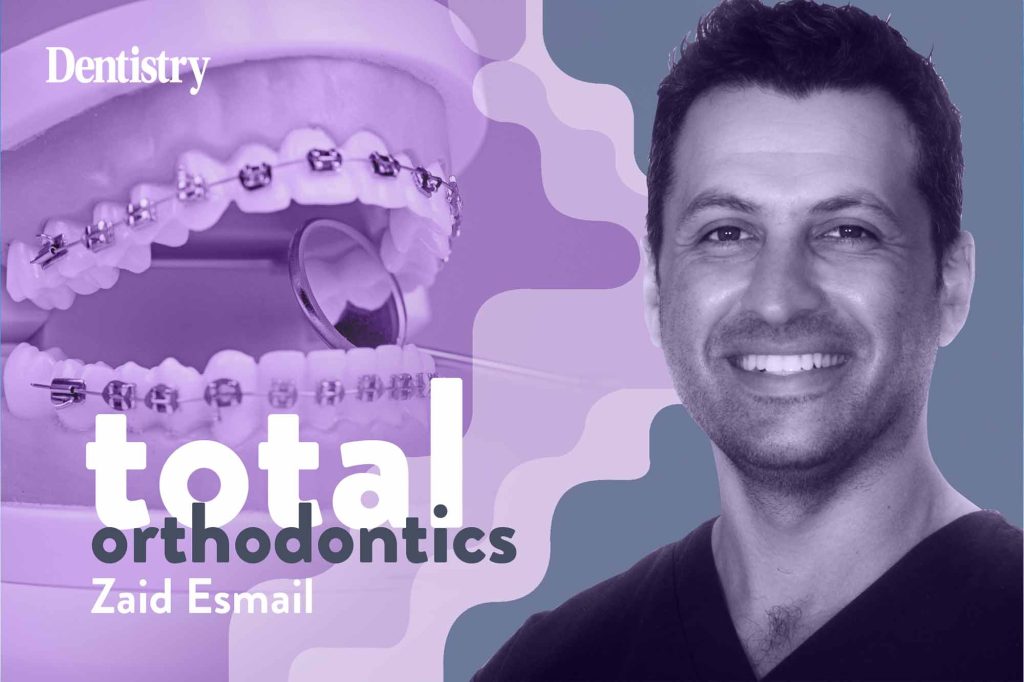 What are fixed functional appliances? - Dentistry