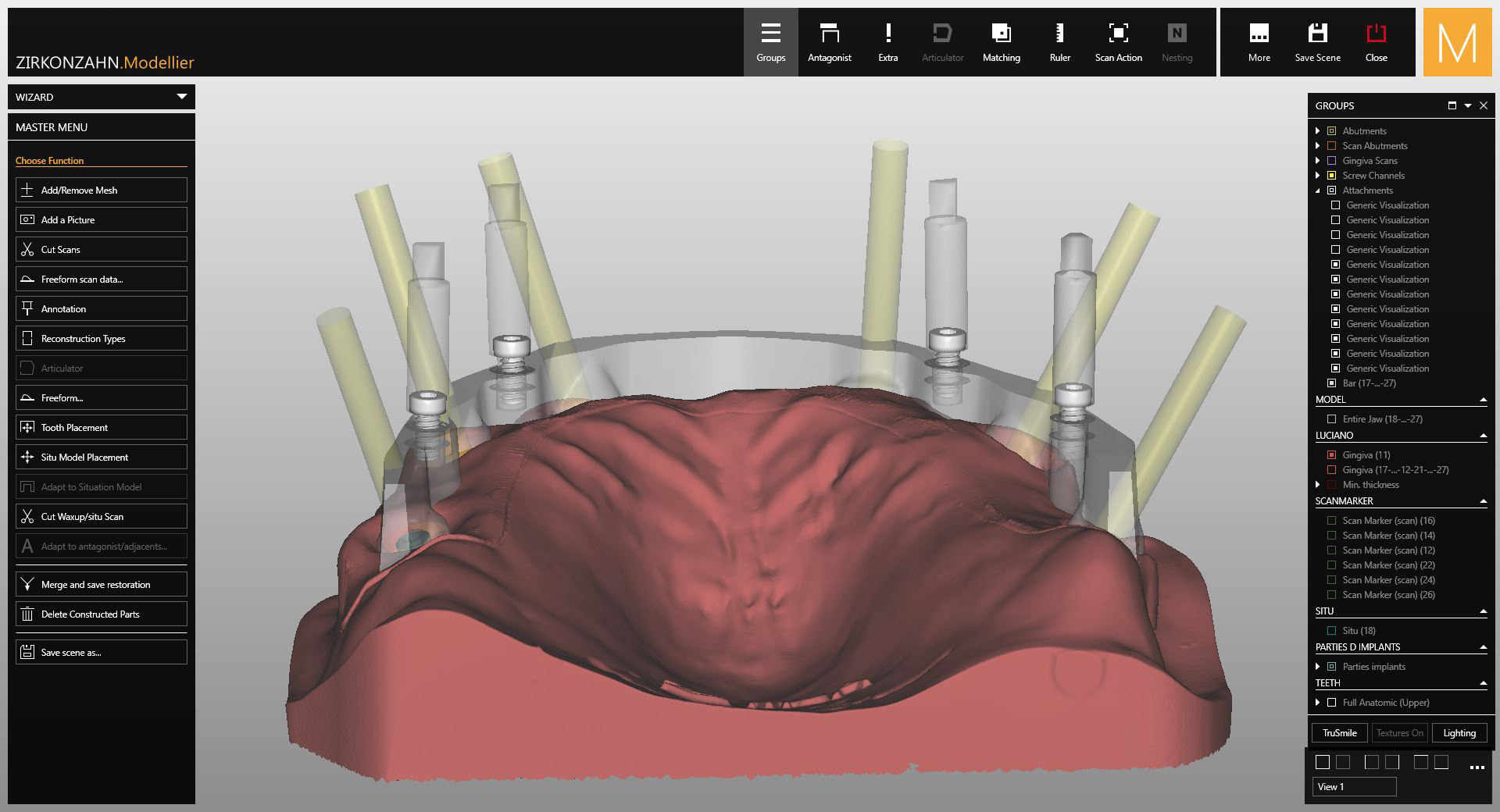 Beilage Double Screw Bar_005(web) - Dentistry.co.uk