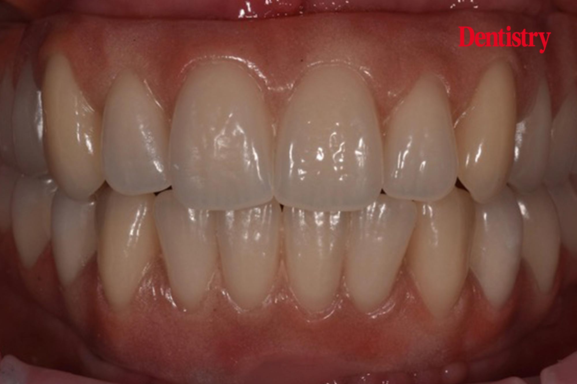 The implant system that lives up to its name - Dentistry