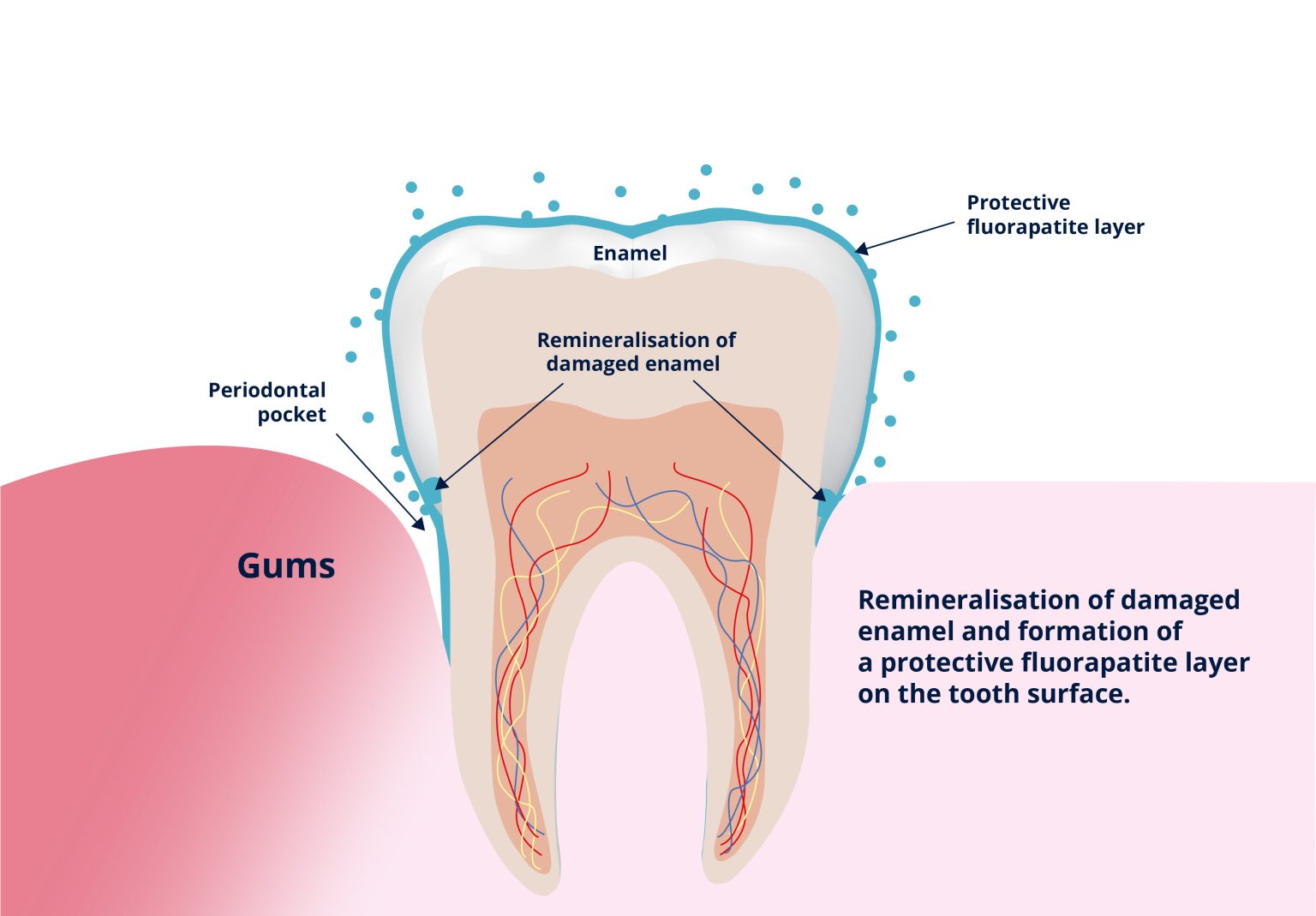 Biomin F – armour for teeth - Dentistry