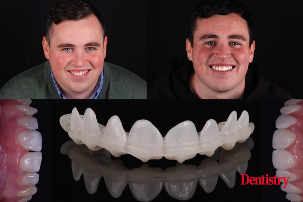 First Fit – showing what is possible in digital dentistry - Dentistry