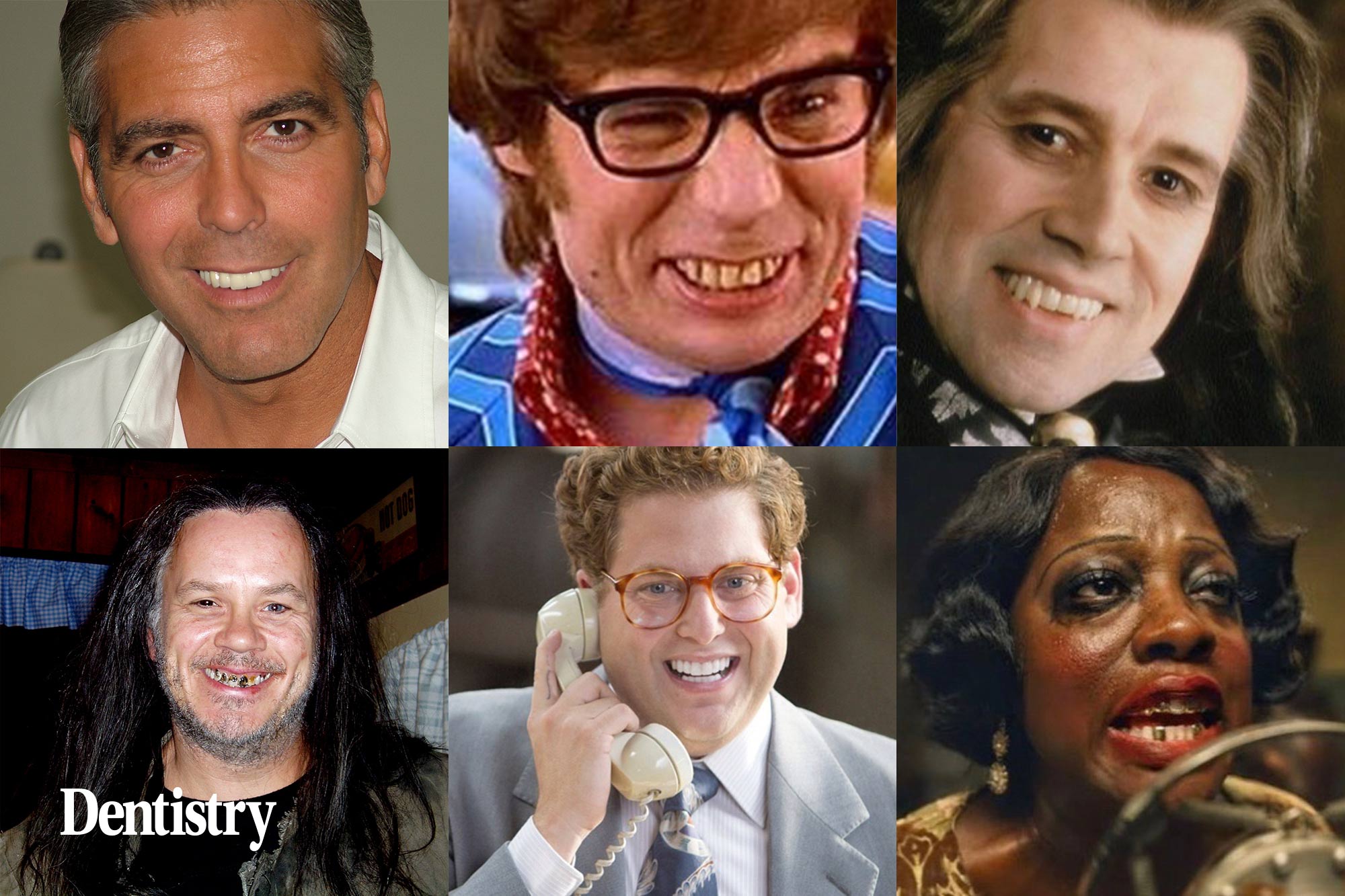 The Godfather of FX teeth – creating teeth for Star Wars - Dentistry