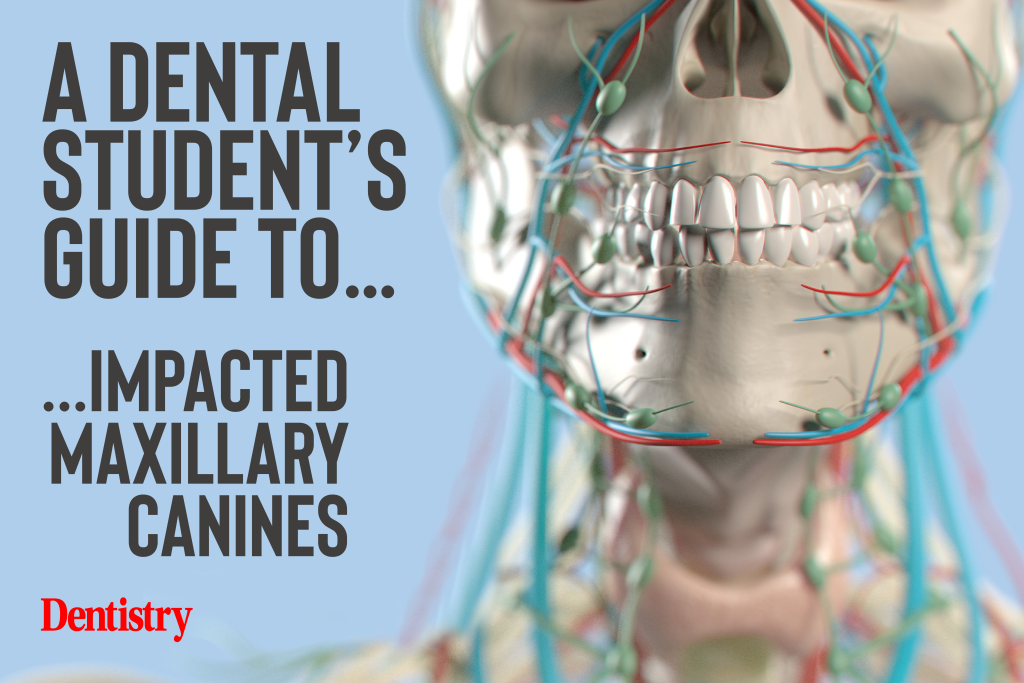 A Dental Student's Guide to...impacted maxillary canines - Dentistry