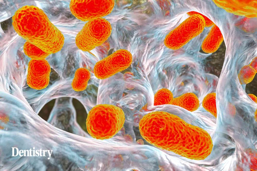 What is biofilm? An updated evidence base - Dentistry