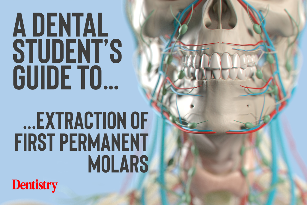 Dental Student's Guide: first permanent molar extraction - Dentistry