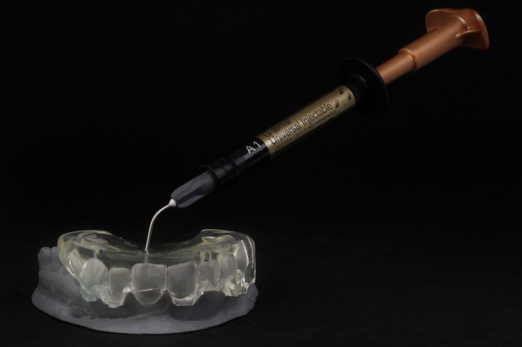 Injectable composites: quick fix or long-lasting solution? - Dentistry