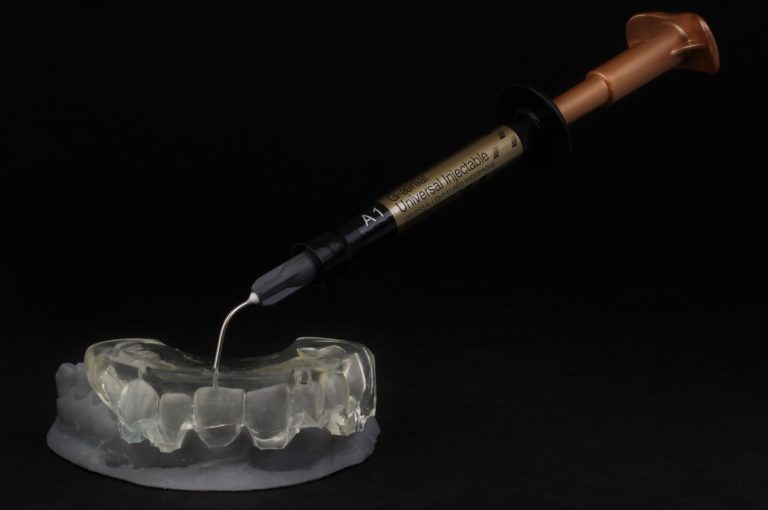 Injectable composites: quick fix or long-lasting solution? - Dentistry