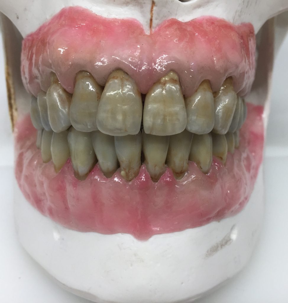 Reconstructing the dentition of a human skull - Dentistry