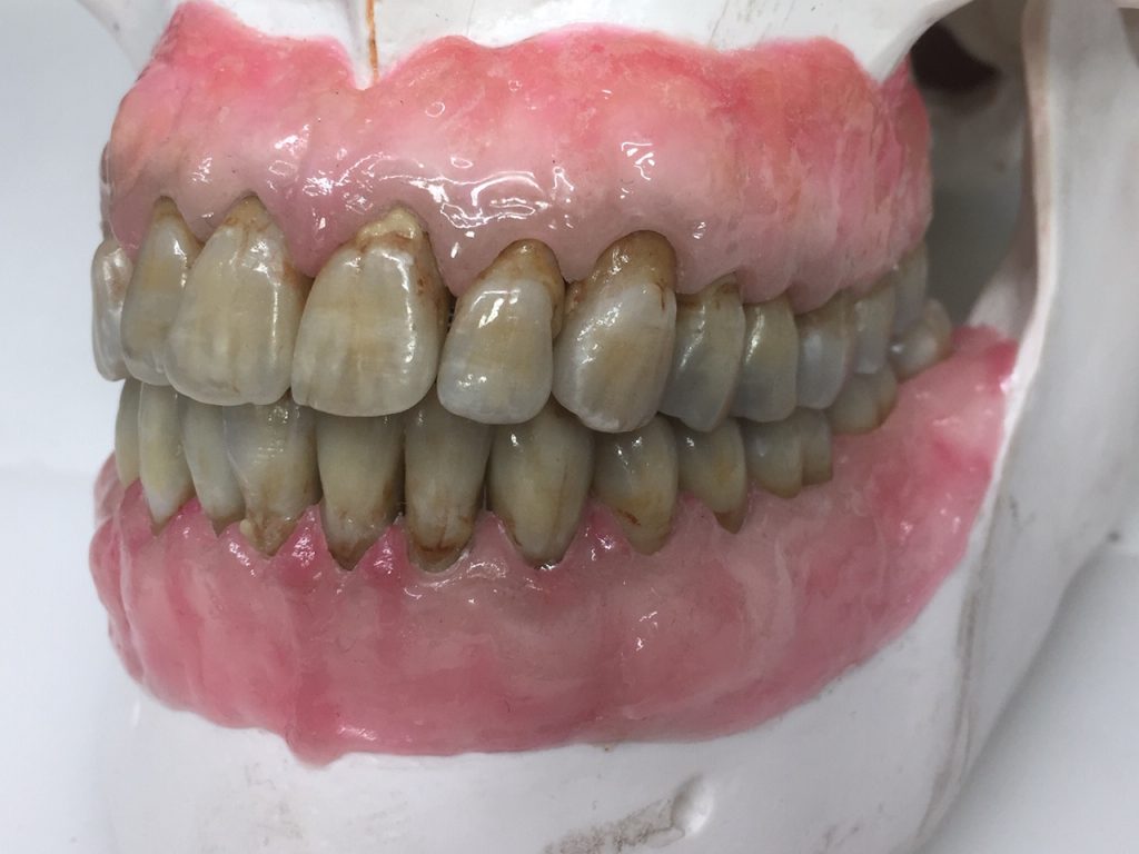 Reconstructing the dentition of a human skull - Dentistry