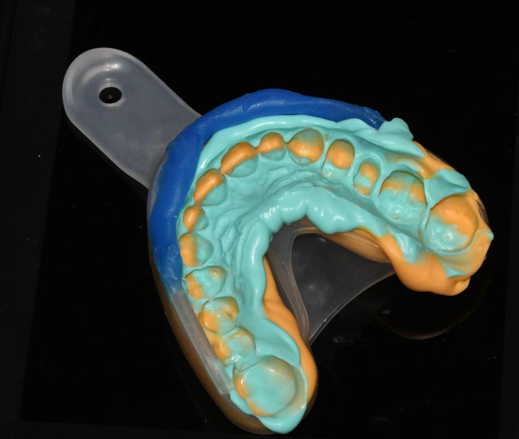 Panasil – providing precise impression results - Dentistry