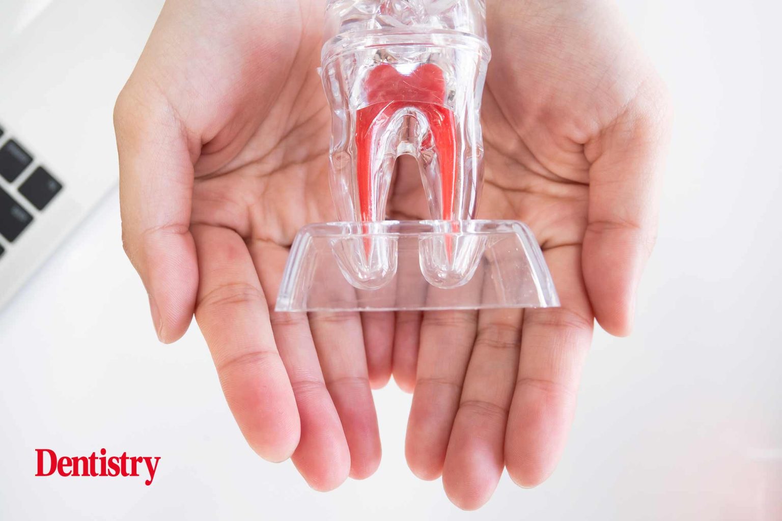 When endo adds up - Dentistry