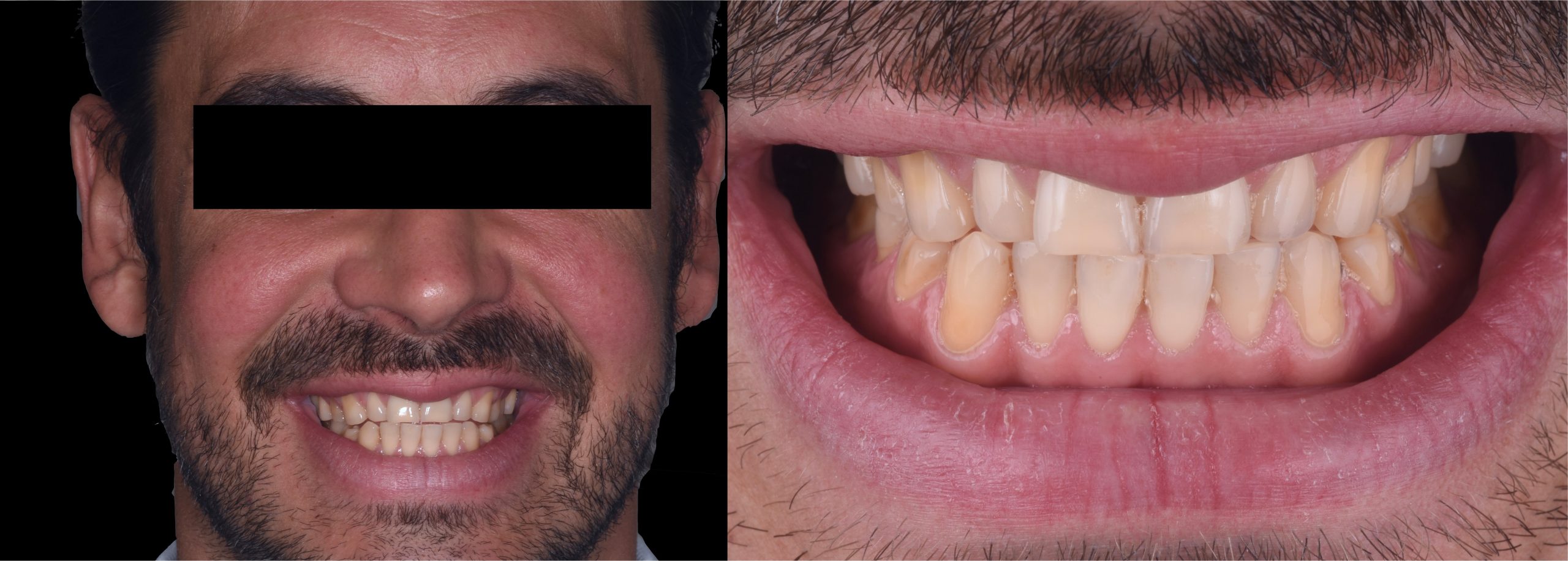 Figure 1_Initial extraoral documentation - Dentistry.co.uk