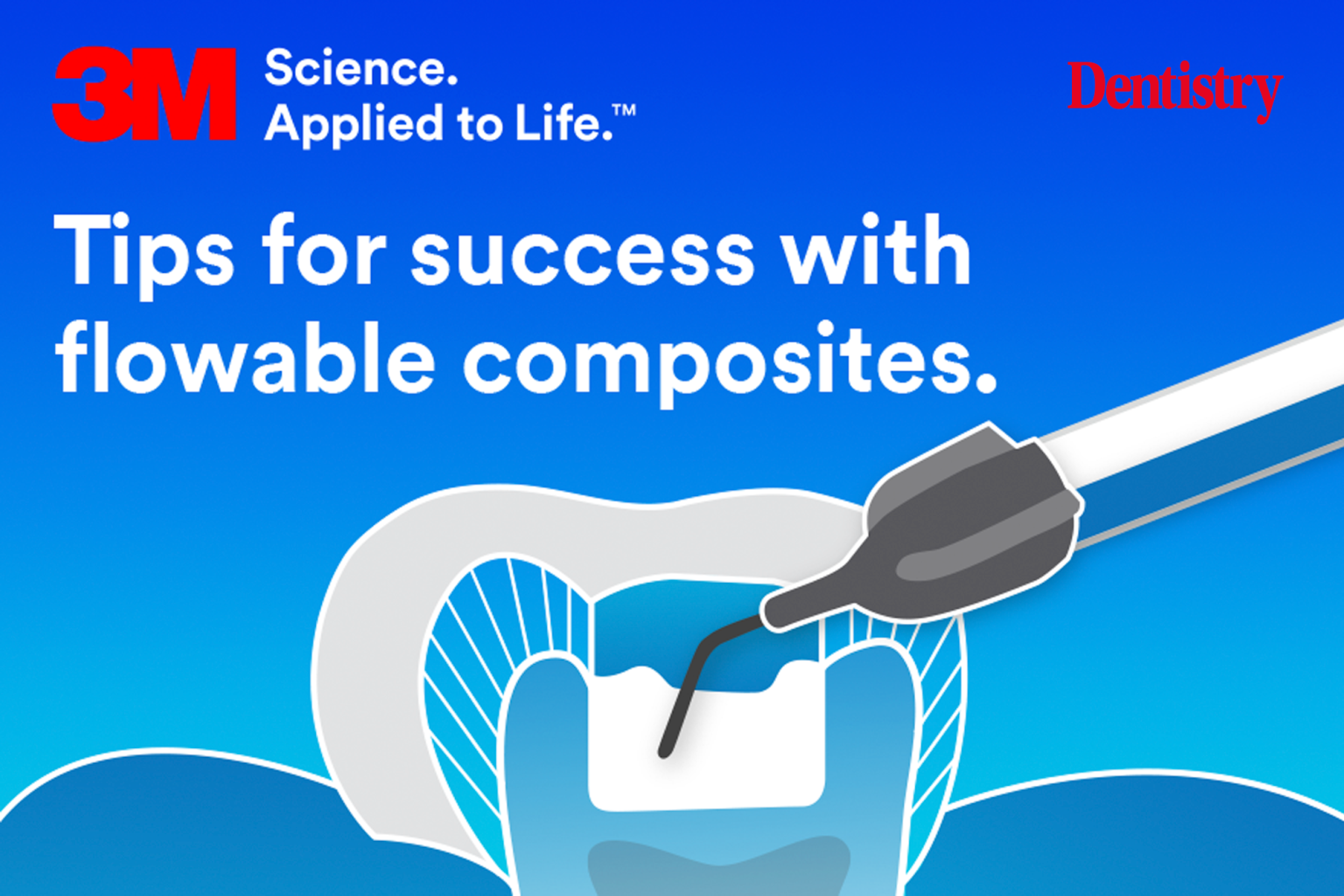 Tips for success with flowable composites - Dentistry