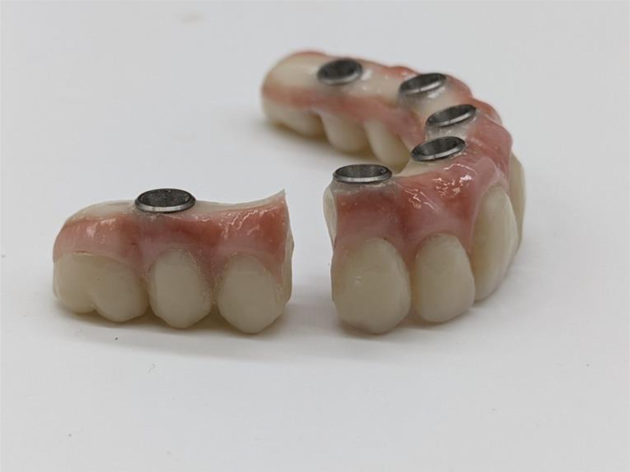 Digital management of functional occlusion - Dentistry