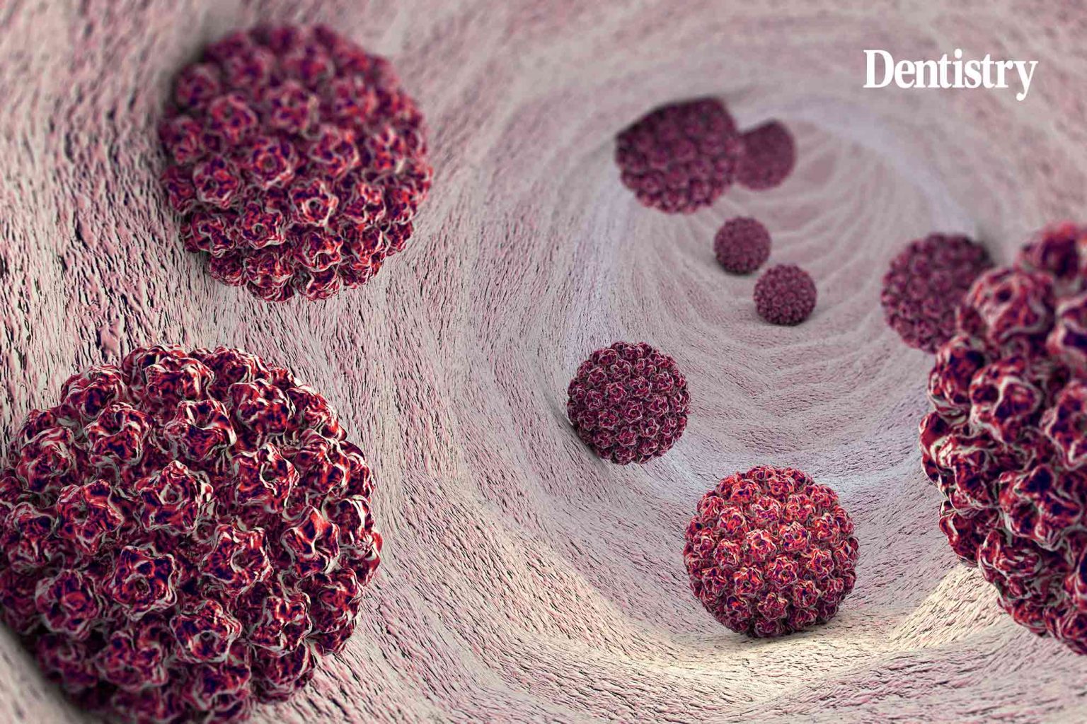 Patients unaware HPV links to throat cancer, study says – Dentistry