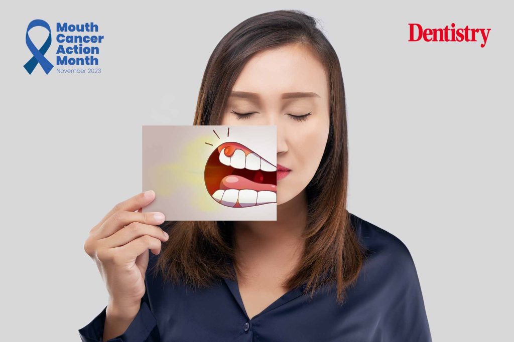 Making a difference this Mouth Cancer Action Month - Dentistry