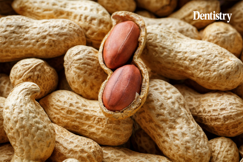 Peanut toothpaste could reduce allergy severity - Dentistry